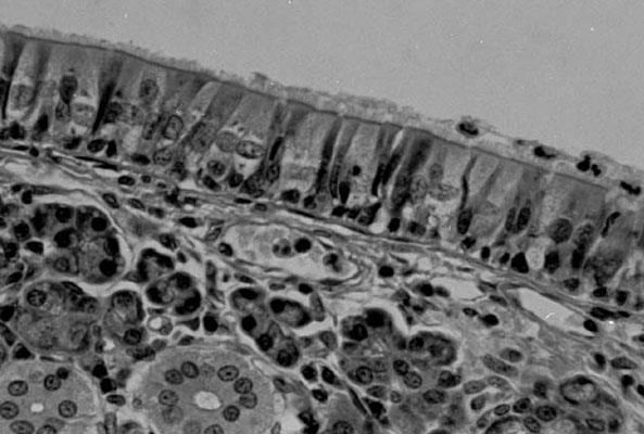 Photomicrographs - epithelial tissues